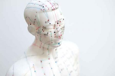 Acupuncture NYC | ACA Acupuncture & Wellness — Top-rated Acupuncture ...