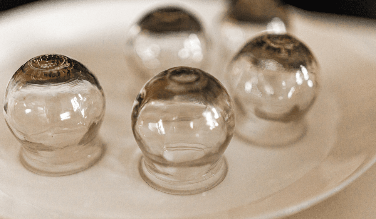 Cupping Therapy NYC | Expert Cupping in New York City | ACA