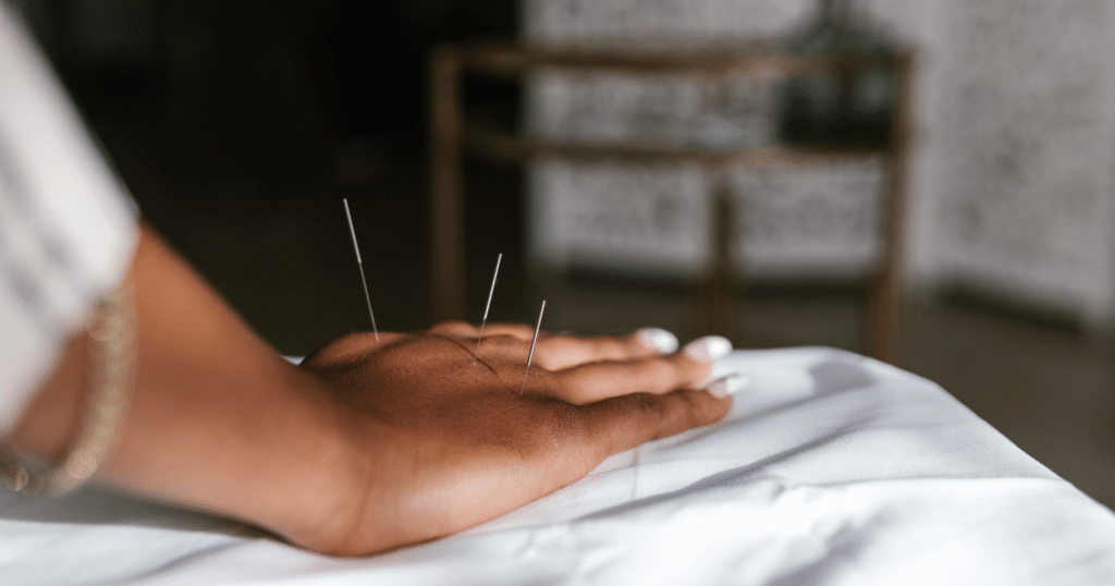 Acupuncture for Arthritis – Does It Really Work?