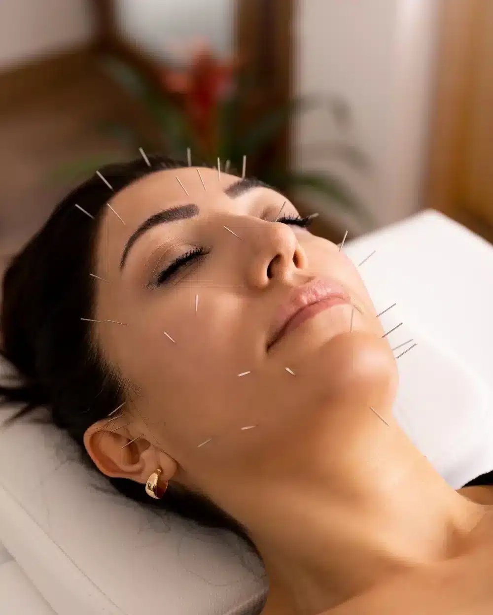 Exploring Moxibustion in Acupuncture: Benefits, Uses, and What to Expect